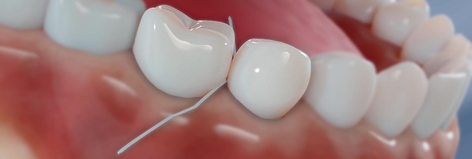 Beyond Brushing: How to Floss with Proper Technique - Prestonwood ...